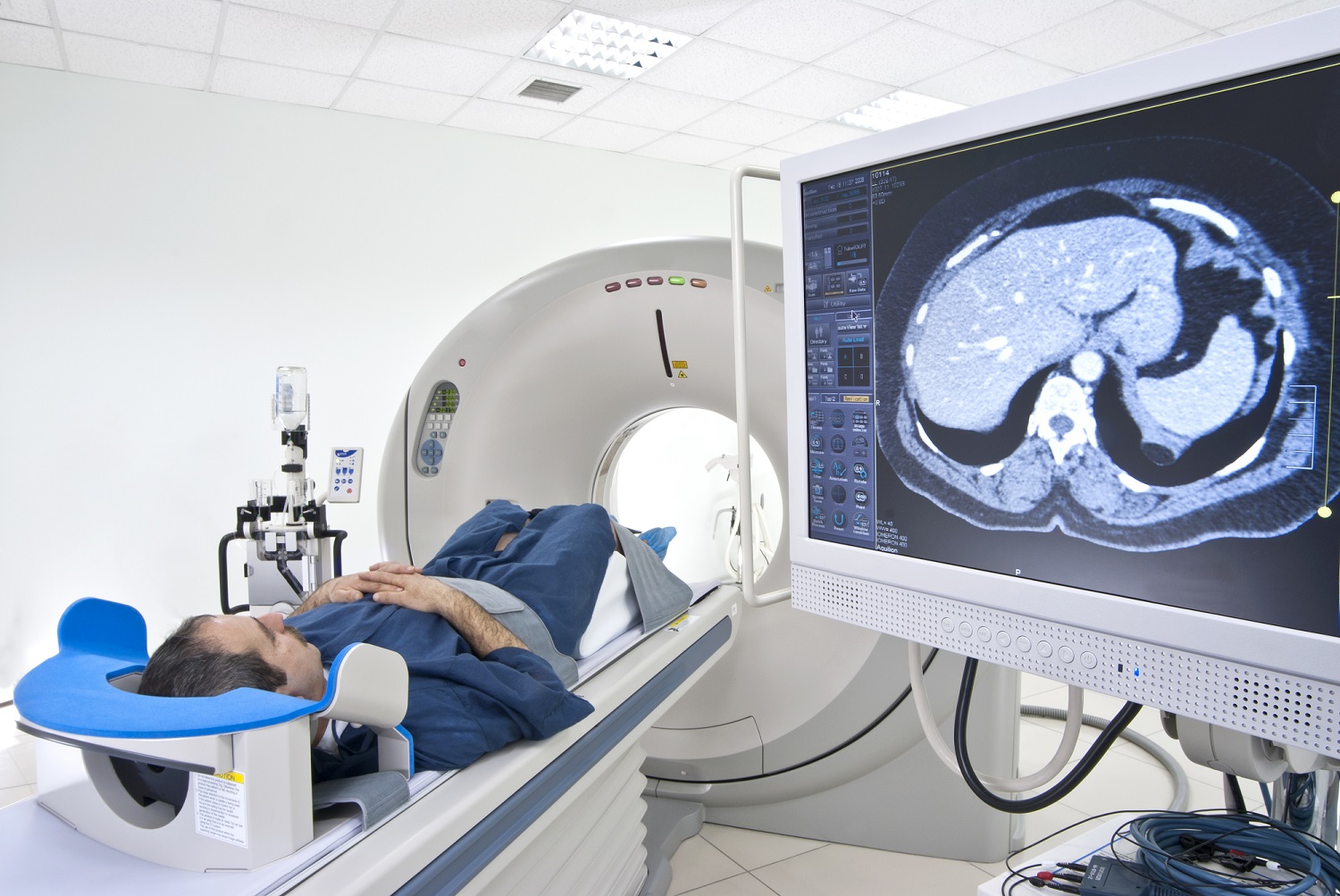 Exploring the Importance of Medical Imaging Services - Vibrant Living Lens